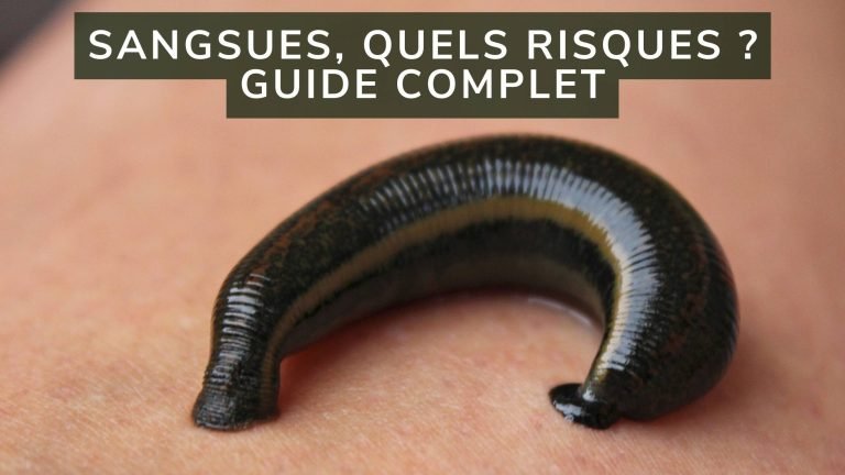 Sangsue: Dangers, Réactions Et Conseils à Adopter